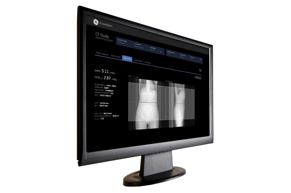 個性発信・話題の商品／GEヘルスケア・ジャパン 「DoseWatch」 | 日刊工業新聞 電子版